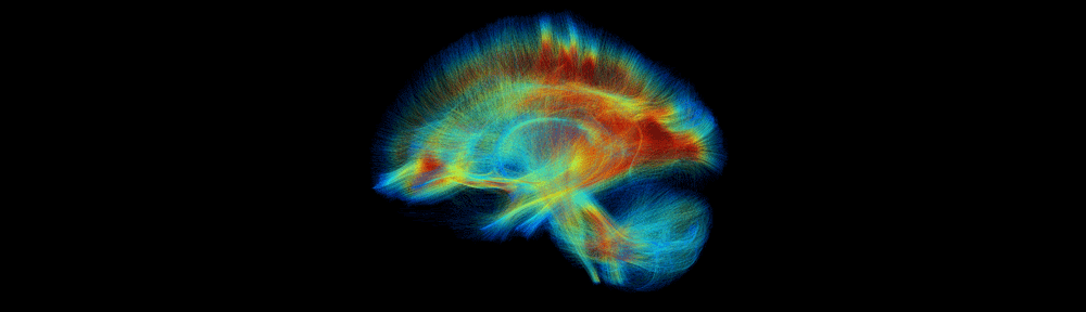 LNCD – Laboratory of Neurocognitive Development